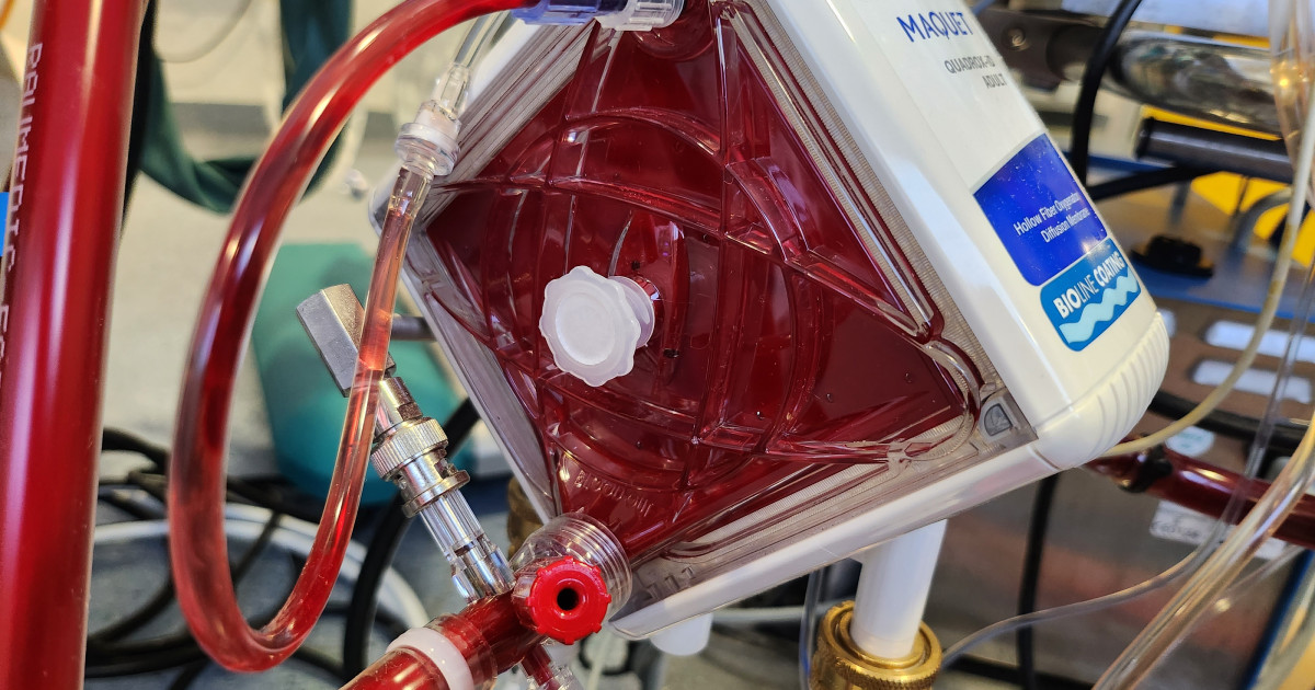 ExtraCorporele MembraanOxygenatie (ECMO) | UZA