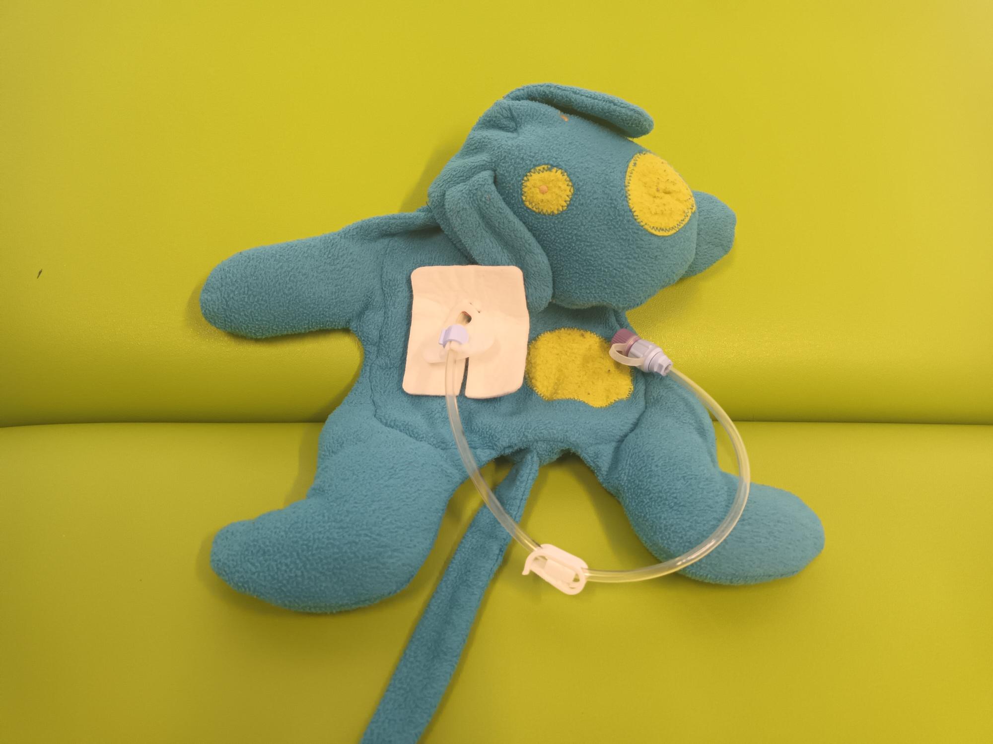 Gastrostomie bij kinderen | UZA